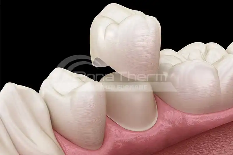 Dental furnace - BROTHER FURNACE