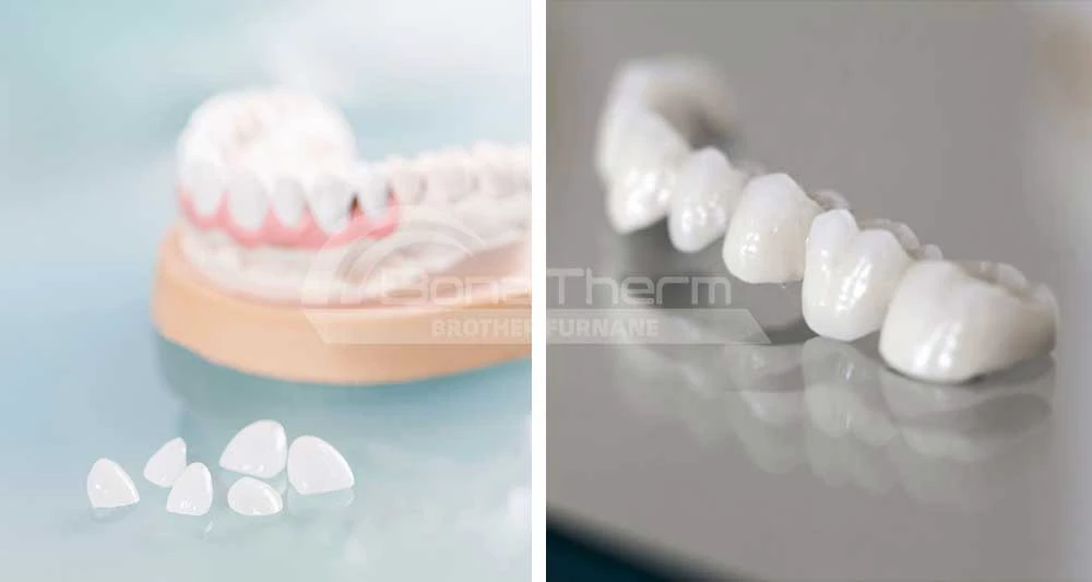 T-Crystal Dental Furnace - BROTHER FURNACE