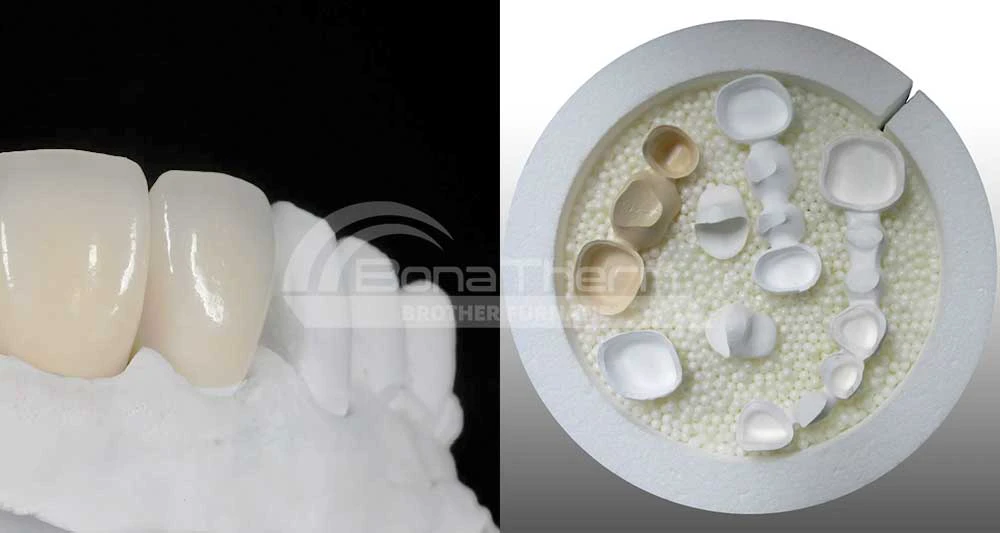 T-Bright dental furnace - BROTHER FURNACE